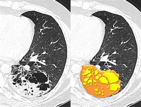 Dra Cecilia Ferrarios Threads Thread Reader App