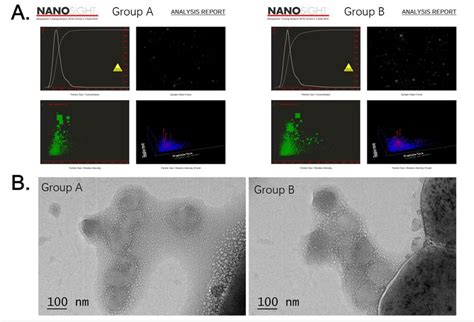 Characterization Of Exosomes Isolated From The Ovarian Follicular Fluid