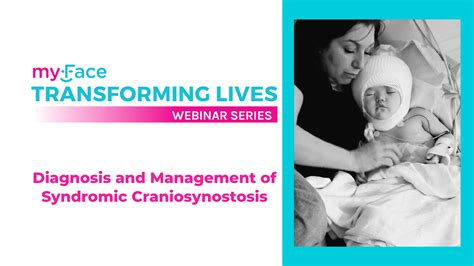 Diagnosis And Management Of Syndromic Craniosynostosis Myface