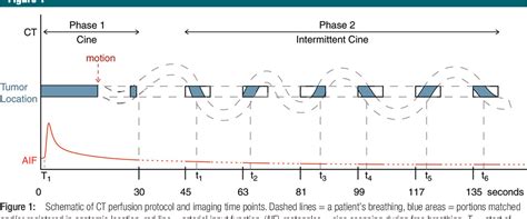 Figure 1 From Reproducibility Of Ct Perfusion Parameters In Liver Tumors And Normal Liver