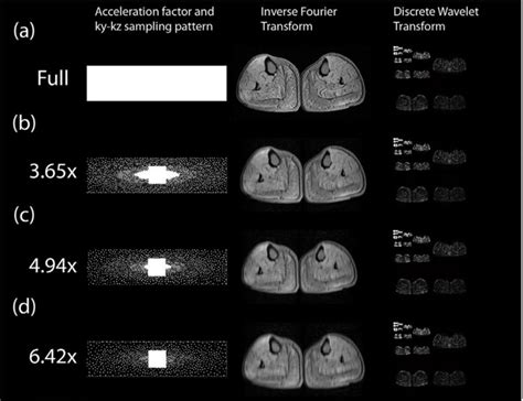 Examples Of Variable Density Undersampling Patterns With Different Download Scientific Diagram