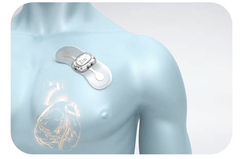 Wearable Ecg Monitors Quytech Blog