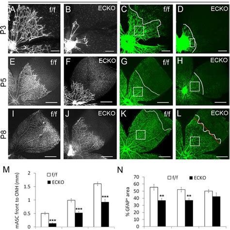 Dual Deficiency In Retinal Vascular Development And Astrocytic
