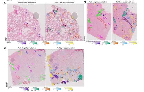 空间转录组细胞niche、细胞频率、通路niche、空间互作、空间hotspot全系列脚本更新（python版本） Csdn博客