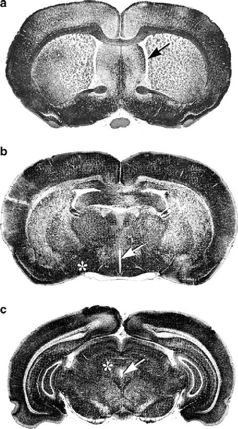 Representative Frontal Sections Of Rat Brain Frontal Sections Of Rat Download Scientific