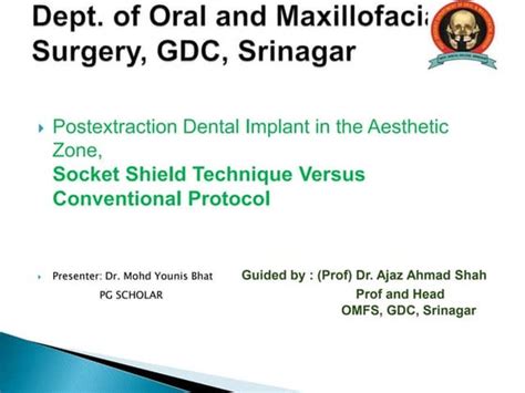 Socket Shield Technique Pptx