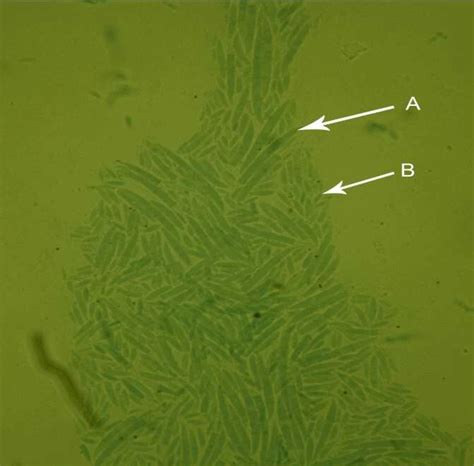 Microconidia B And Macroconidia A In Fusariumoxysporum Left Download Scientific Diagram