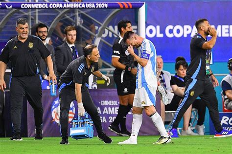 Poza 10 Atenție Imagini Horror Glezna Lui Messi Distrusă în