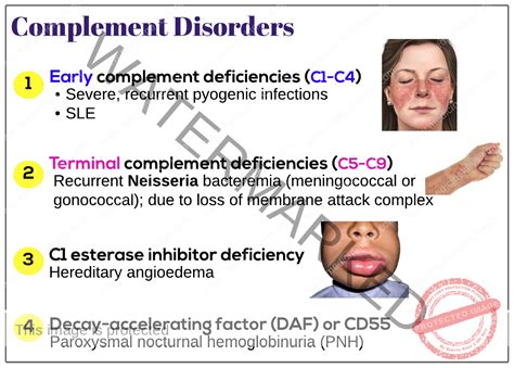 Complement Disorders Medicine Keys For MRCPs