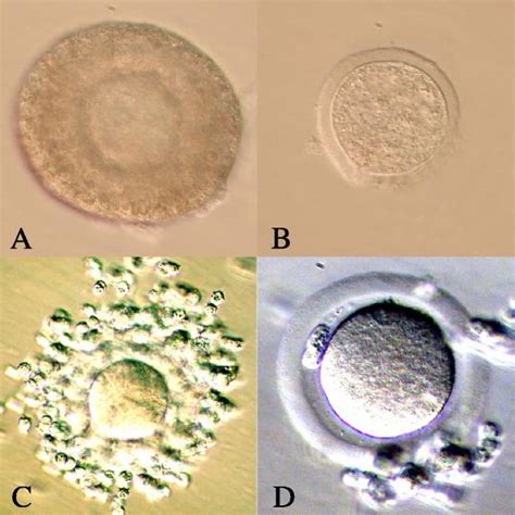 Representation Of Isolated Cells A Cumulus Enclosed Oocyte At The
