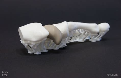 Biocompatible Implants 3d Printing Supports Medical Sector Apium 3d Technologies Gmbh