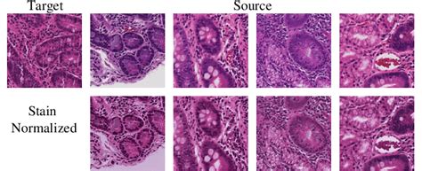 Color Normalization Artifacts When Using The Method Proposed By Download Scientific Diagram