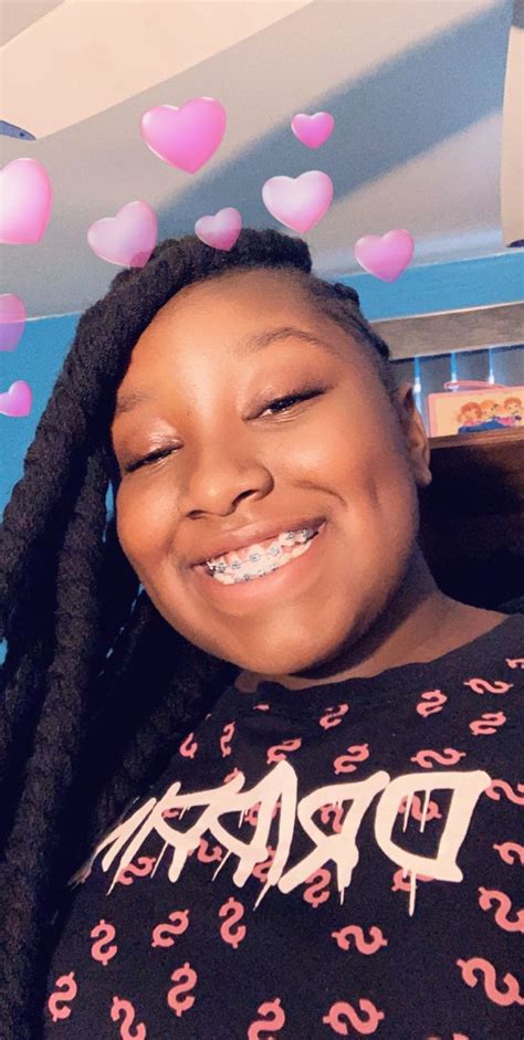 Braceface Insta Xo Samuyha Xo Insta Quick Braces