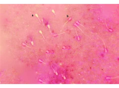 Sperm Viability Observed Under Phase Contrast Microscope 200x A