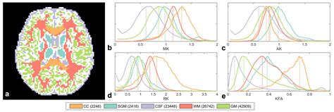 Table 1 The Diffusion Protocols Onfour Scanners For Each Scanner The Diffusion Sequence Was
