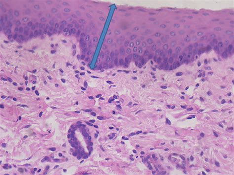 复层扁平上皮红蓝单层扁平上皮红蓝复层扁平上皮红蓝手绘大山谷图库