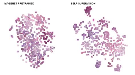 Github Ml And Mlsimclr Pathology Implementation Of Simclr Customized For Training On High