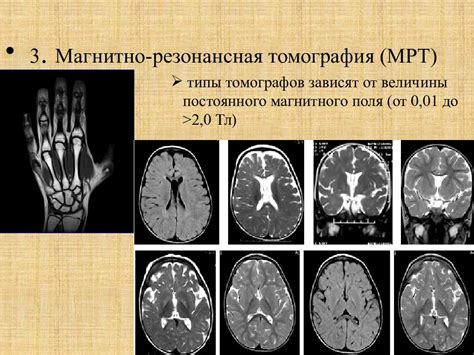 Введение в лучевую диагностику — презентация