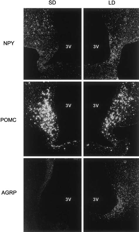 Representative Dark Field Micrographs 2 Magnification Of Neuropeptide
