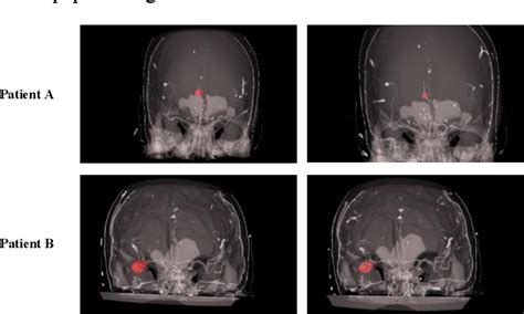 Figure 4 From Glut Net Trans Based Segmentation Network For