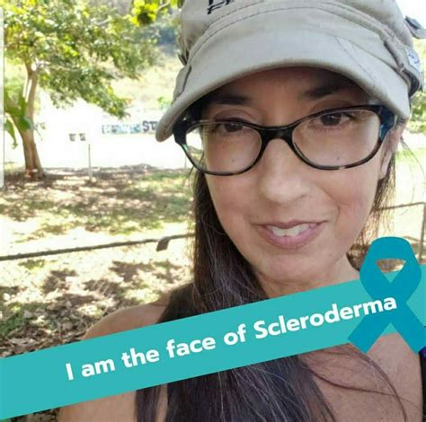 Angels Sharing Angels Sharing Scleroderma Awareness