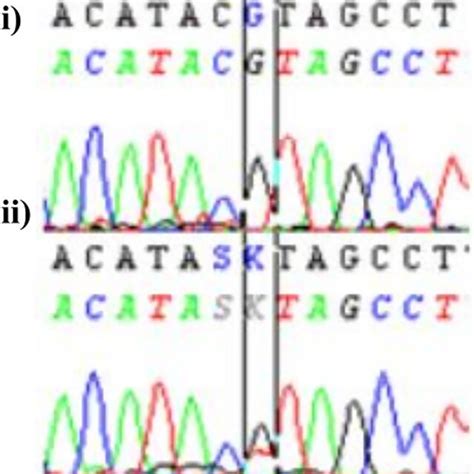 Dna Sequencing Chromatograms Of The C10orf71 Missense Variant