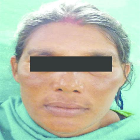 Extraoral Photograph Frontal View Download Scientific Diagram