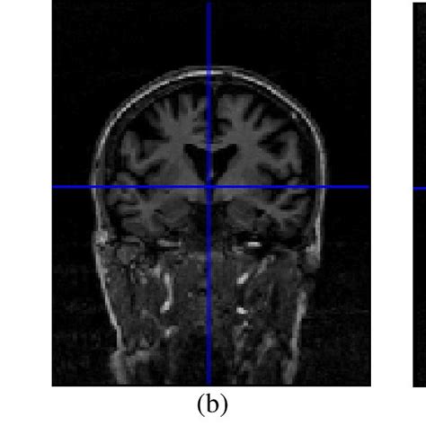 MRI Centered At Anterior Cingulate Cortex Position A Axial B Download Scientific Diagram