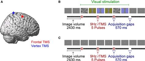 Figure 1 From Concurrent Tms Fmri And Psychophysics Reveal Frontal