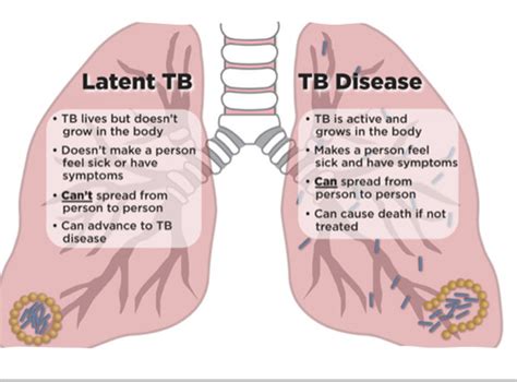 Tb Lecture Flashcards Quizlet