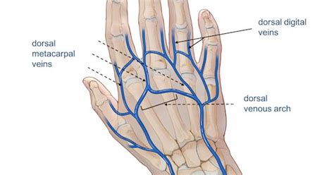 Radial Artery Second Dorsal Metacarpal Vein Arteriovenous 58 Off