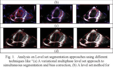 Figure From A Study On Various Segmentation Approaches Using Echocardiogram Images For