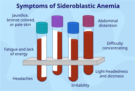 Lab Tests For Sideroblastic Anemia At Jesse Richardson Blog
