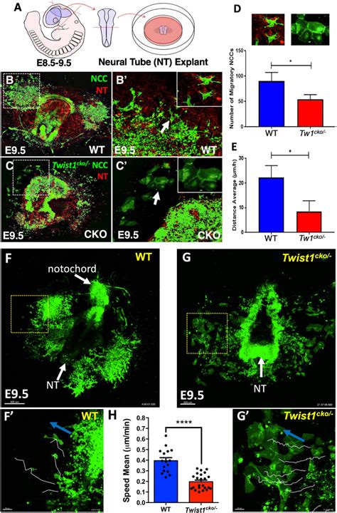 Twist1 Interacts With βδ Catenins During Neural Tube Development And