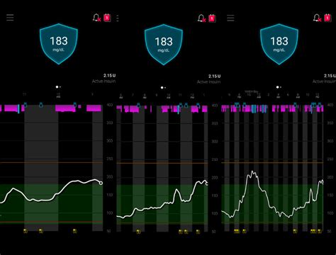 Understanding Your Cgm Data The Ups Downs And Realistic Expectations