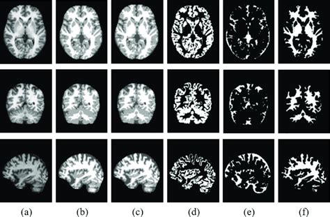 Illustration Of Segmentation Results Obtained For Our Proposed Method Download Scientific