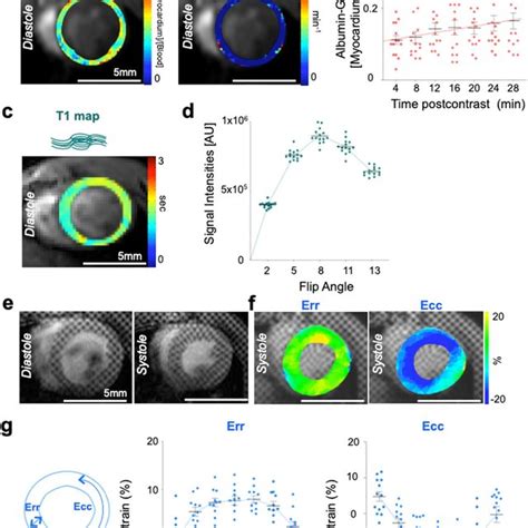 Serial Contrast Enhanced Cardiac Mri Shows Altered Vascular Features