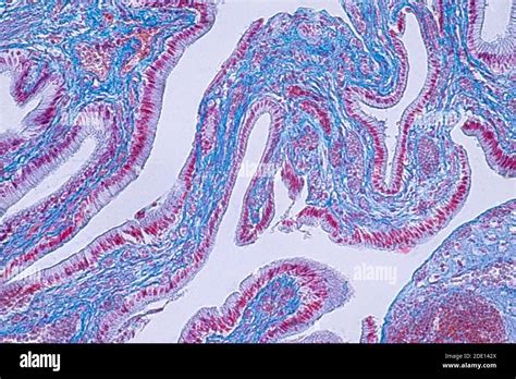 Ciliated Epithelial Cell Microscope