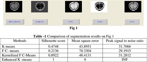 Figure 1 From Medical Image Segmentation Using Enhanced K Means And Kernelized Fuzzy C Means