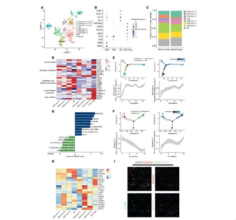 Classification And Analysis Of T Cells In Cystitis Glandularis A