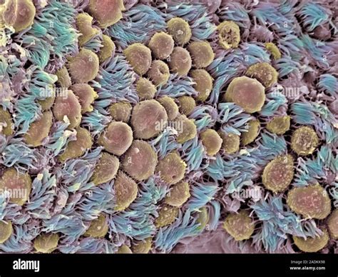 Fallopian Tube Coloured Scanning Electron Micrograph SEM Of The