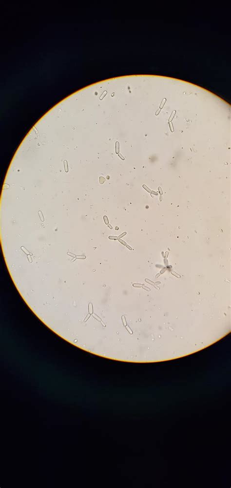 Fecal Float Under The 40x Scope Anybody Know What The Giant Rod Looking Things Are R Vettech