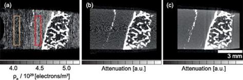 Implementation Of A Double Grating Interferometer For Phase Contrast