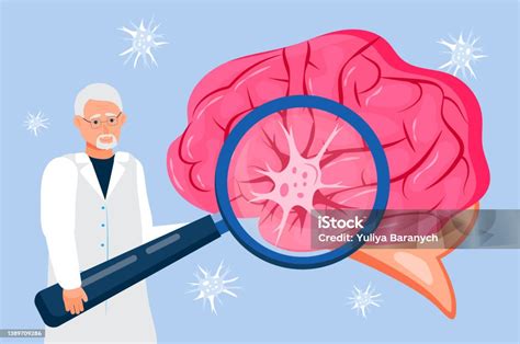 의학 블로그 의료 블로그에 대한 신경학자 개념 벡터 Ekg 뇌병기와 뇌 다발성 경화증에 대한 스톡 벡터 아트 및 기타 이미지 다발성 경화증 뇌종양 뇌 Istock