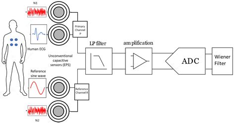 An Experimental Method For Bio Signal Denoising Using Unconventional