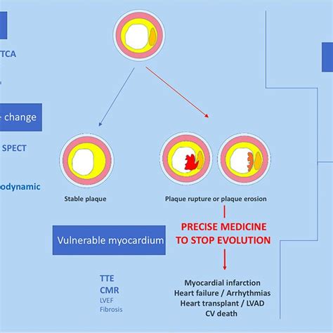 proposition of non invasive multimodality imaging strategy to detect