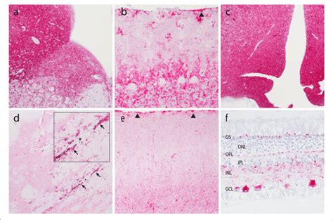 Accumulation Of Prp Sc In The Central Nervous System Representative Download Scientific