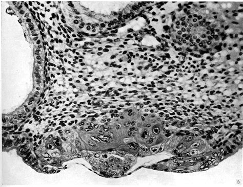 Carnegie Stage 5a 1 3 Section Through The Middle Of The Embryo