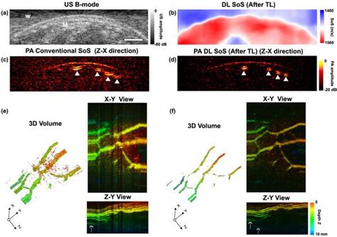 A New Sound Speed Correction Algorithm Using Transfer Learning Has Been Released