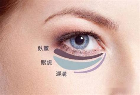 怎樣才能去除眼袋